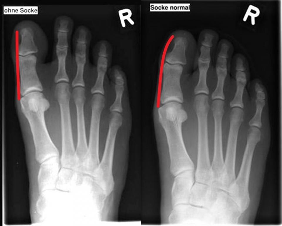 How much space do we need in shoes? - Barefoot Universe