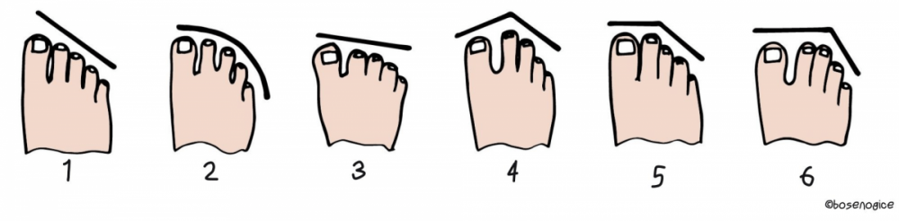 7 Foot Types You Need to Know Before Choosing Barefoot Shoes - Barefoot ...
