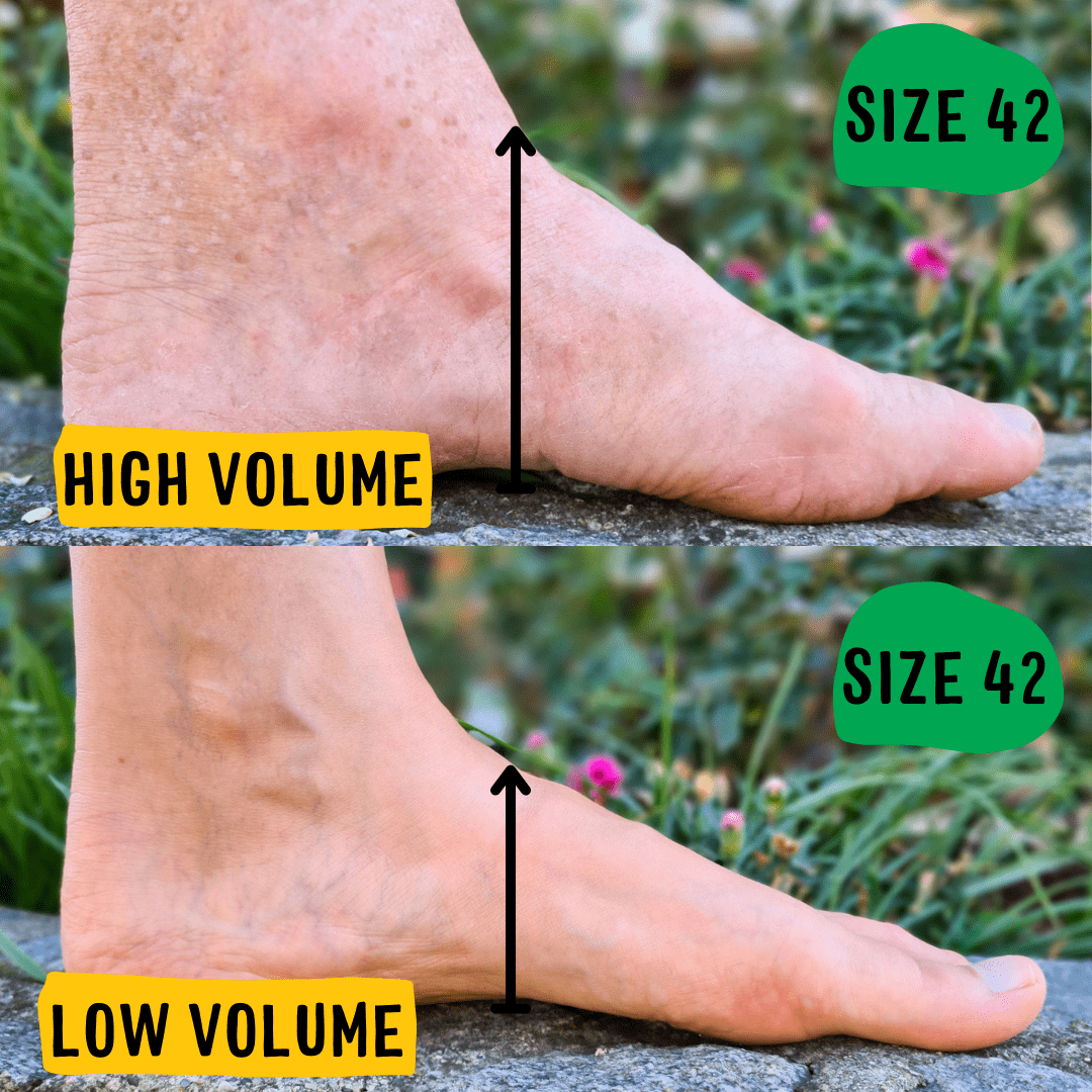 7 Foot Types You Need to Know Before Choosing Barefoot Shoes - Barefoot ...