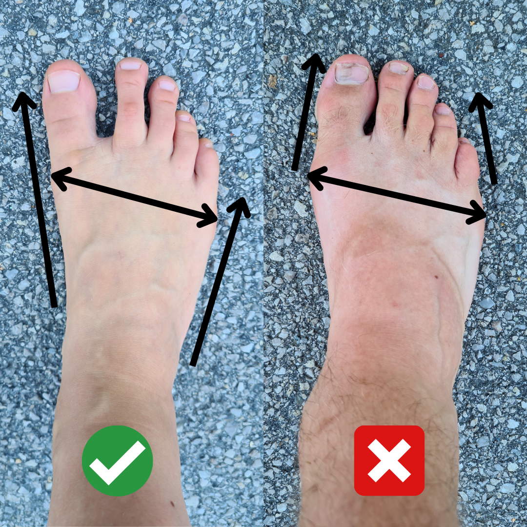 7 Foot Types You Need to Know Before Choosing Barefoot Shoes - Barefoot ...