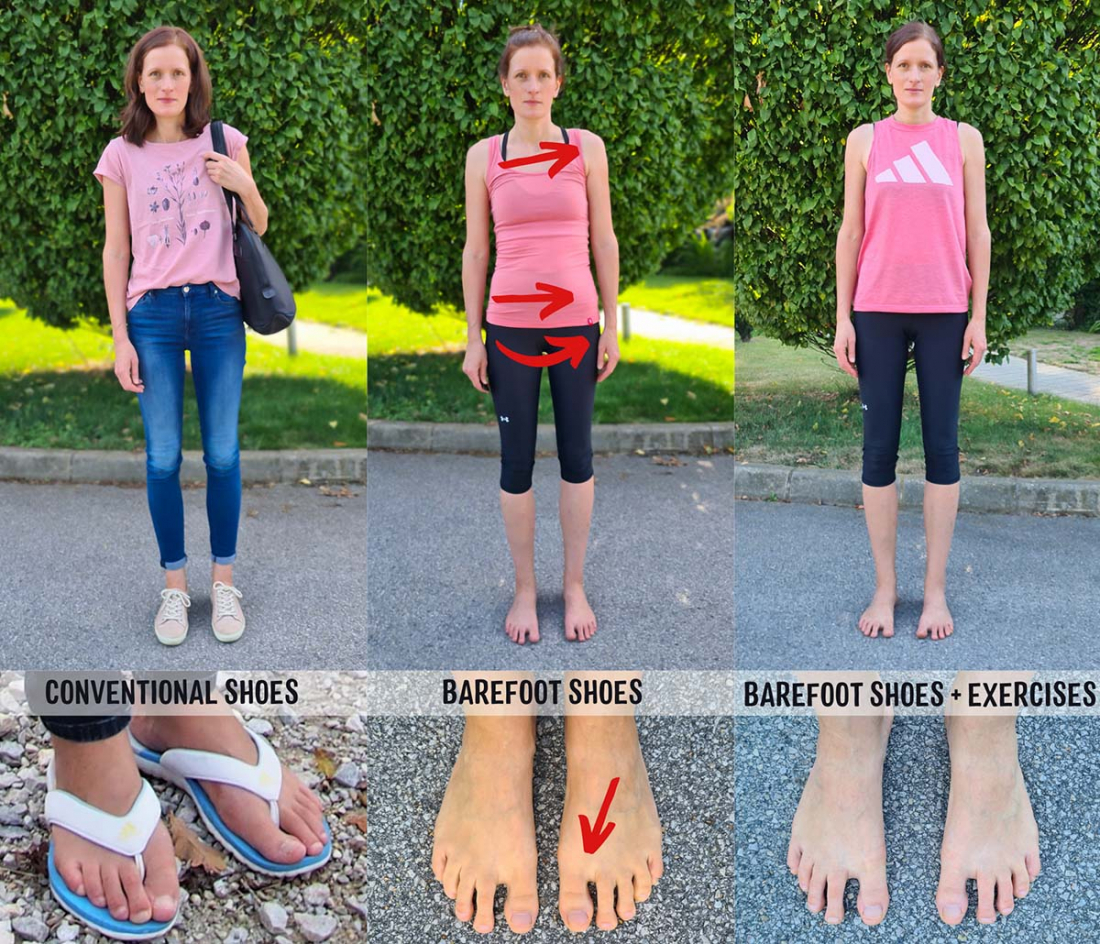 How to Safely Transition to Barefoot Shoes: A Guide for Newbies ...