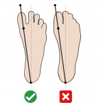 7 Foot Types You Need to Know Before Choosing Barefoot Shoes - Barefoot ...