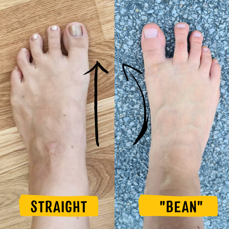 7 Foot Types You Need to Know Before Choosing Barefoot Shoes - Barefoot ...