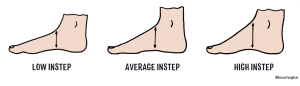 7 Foot Types You Need to Know Before Choosing Barefoot Shoes - Barefoot ...