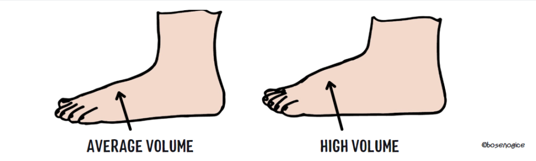 7 Foot Types You Need to Know Before Choosing Barefoot Shoes - Barefoot ...