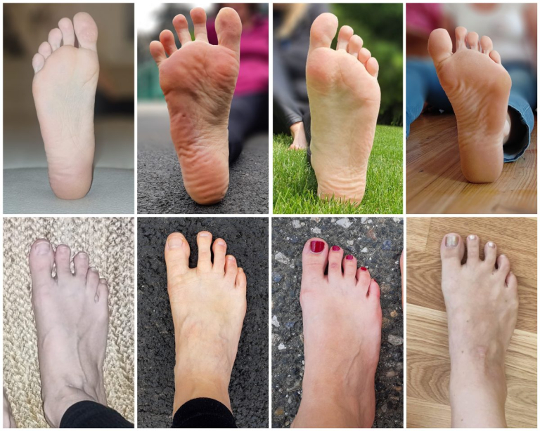 7 Foot Types You Need to Know Before Choosing Barefoot Shoes - Barefoot ...