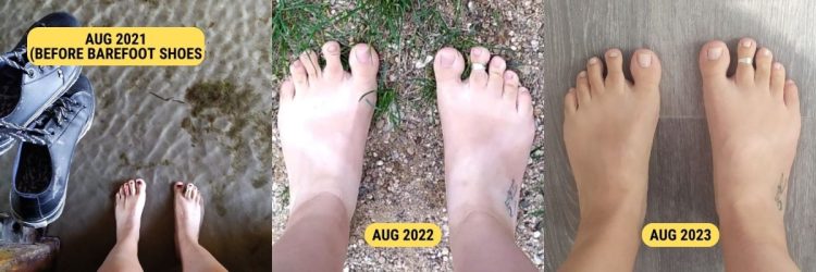 A Year In Barefoot Shoes: The Astonishing Before And After Results ...