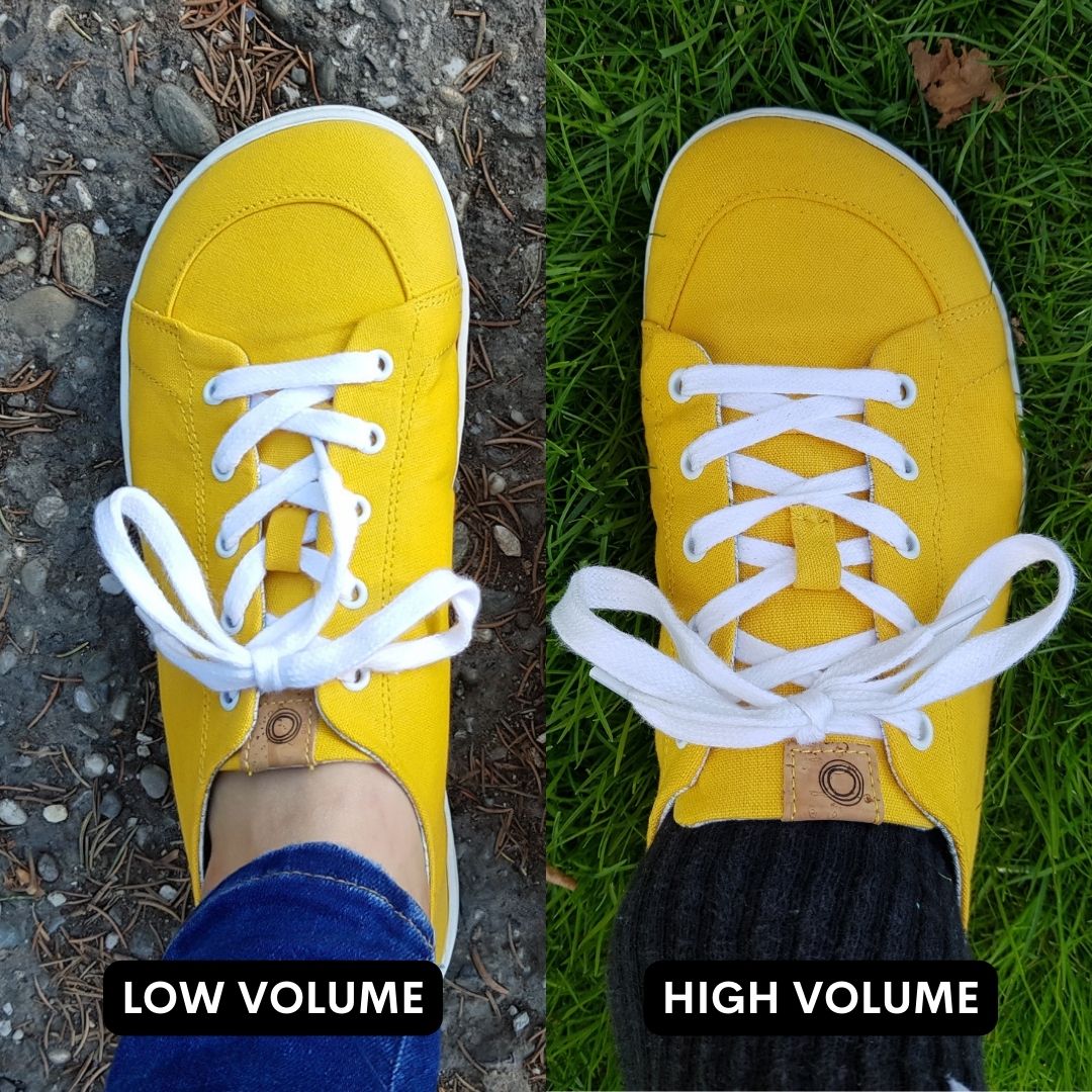 7 Foot Types You Need to Know Before Choosing Barefoot Shoes - Barefoot ...